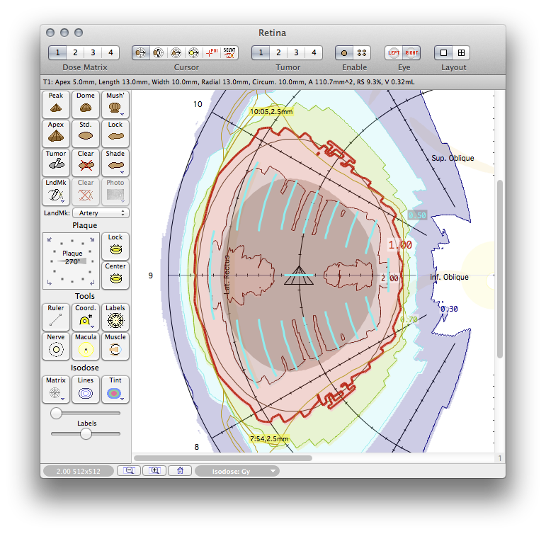 Eye Physics Model 1517e